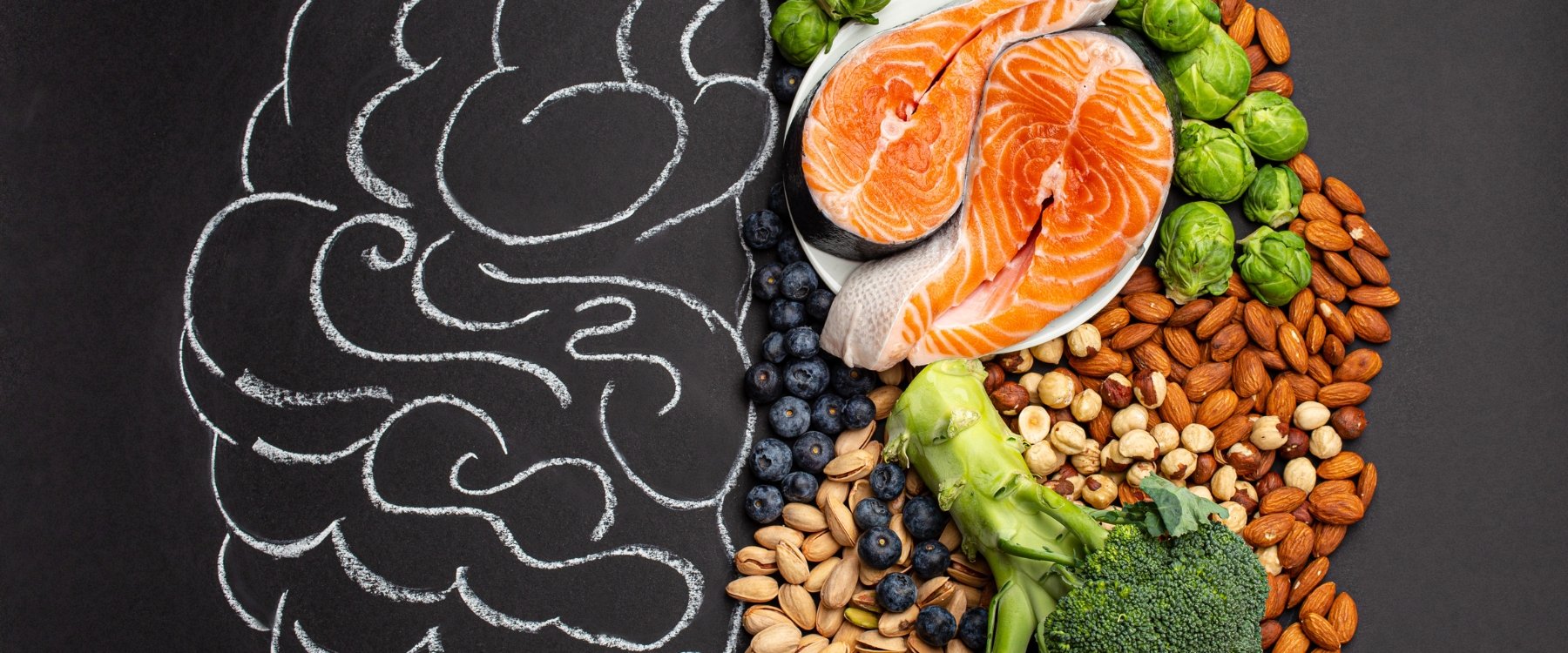 5-ways-to-support-brain-health-776113.jpg?v=1676596131